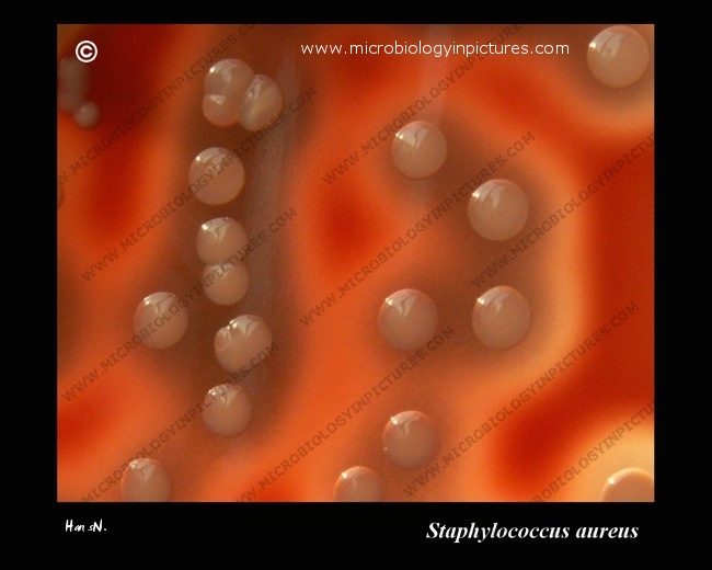 Beta Hemolysis Staphylococcus Aureus